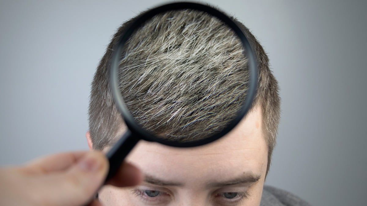 Capelli bianchi: perché vengono, come trattarli al meglio o come ...